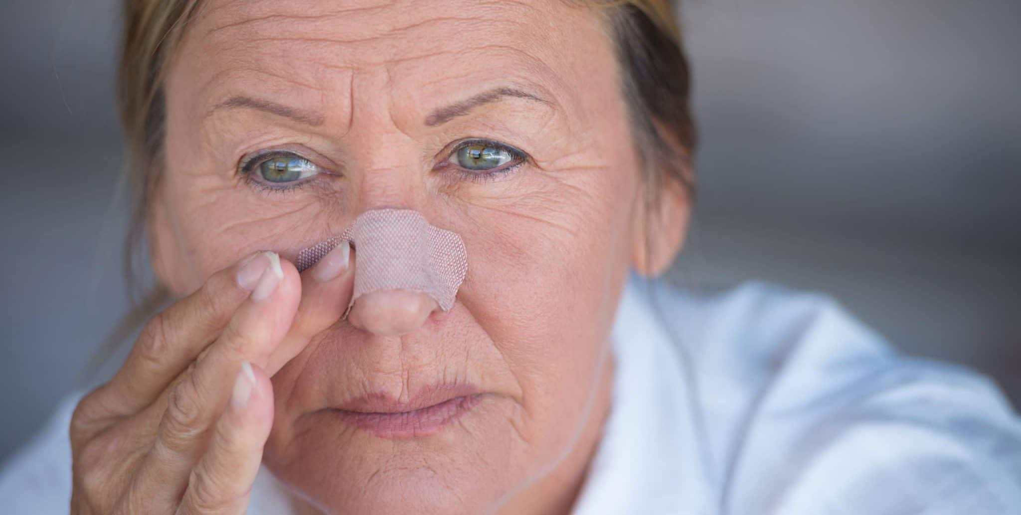 Nasal Fracture - ENT Specialists Of Northern Virginia